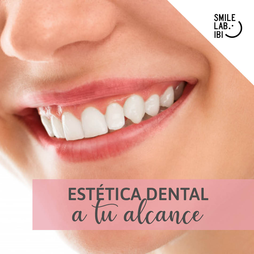 SMILE LAB IBI – Guía Comercial Ibi – Comisión de Fiestas